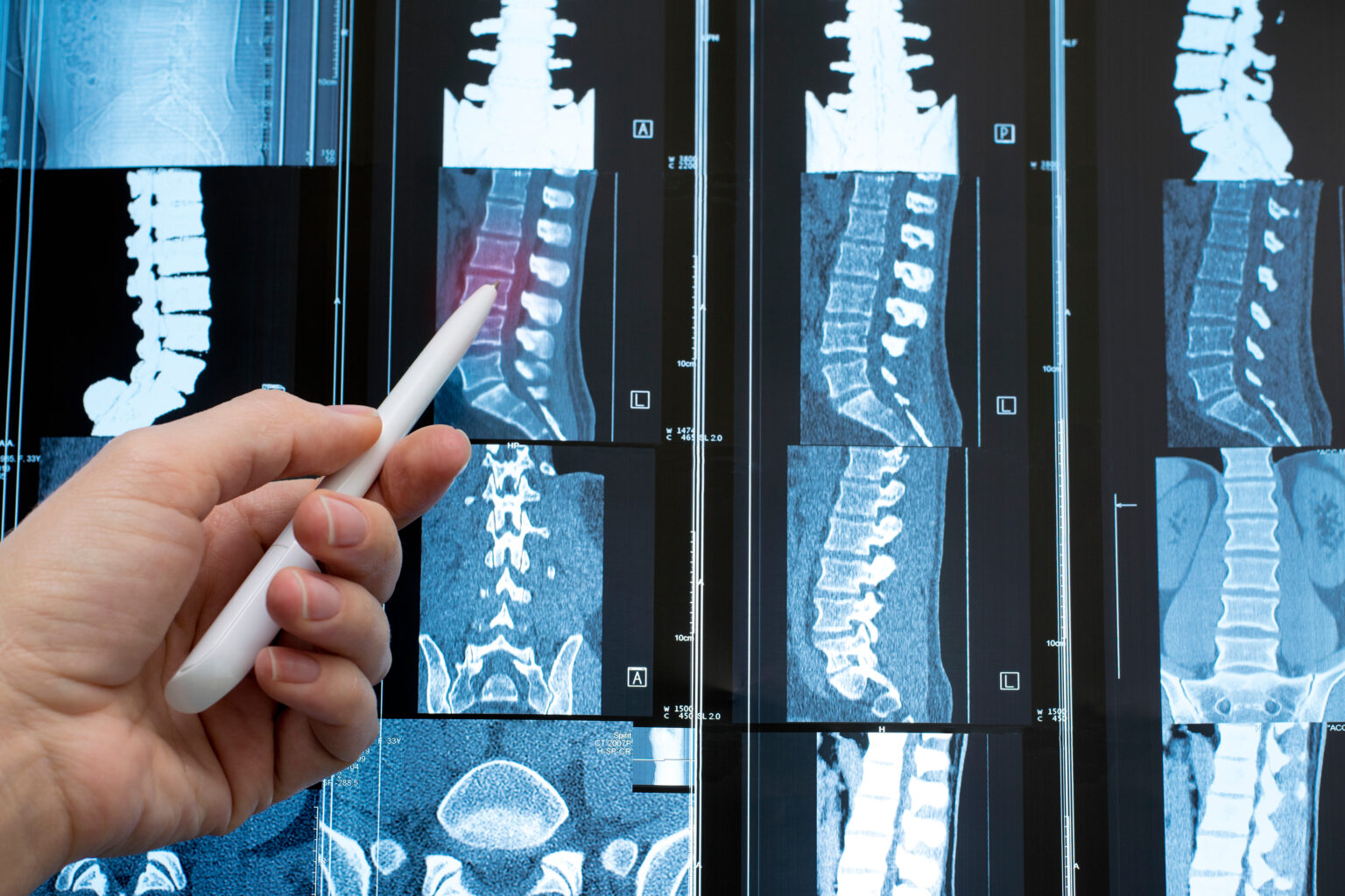 Blog - Total Spine and Orthopedics