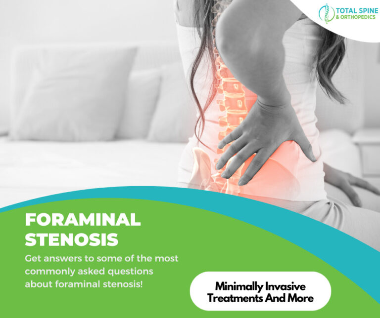 Understanding Foraminal Stenosis - Total Spine and Orthopedics