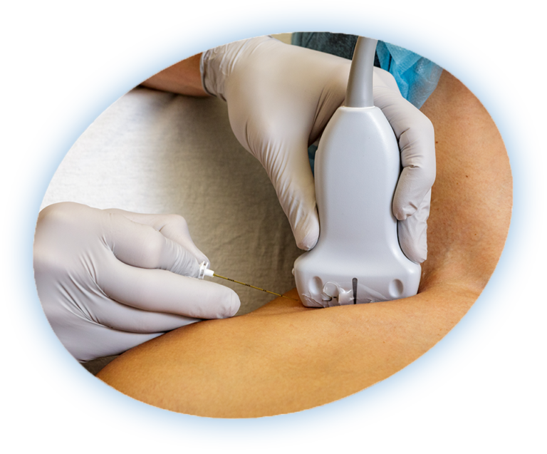 Nerve Block Injections - Total Spine and Orthopedics