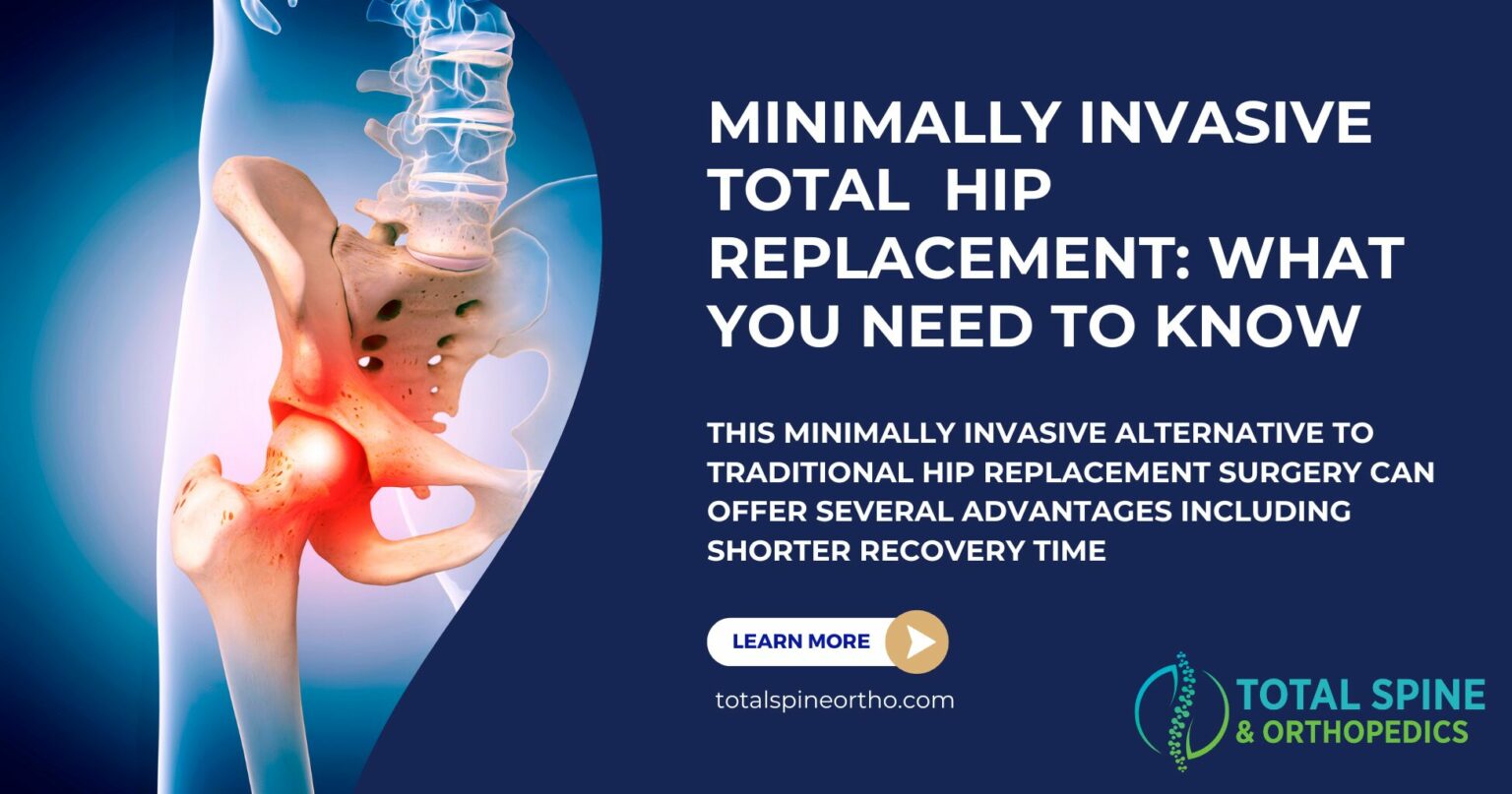 The Benefits of Minimally Invasive Total Hip Replacement - Total Spine ...